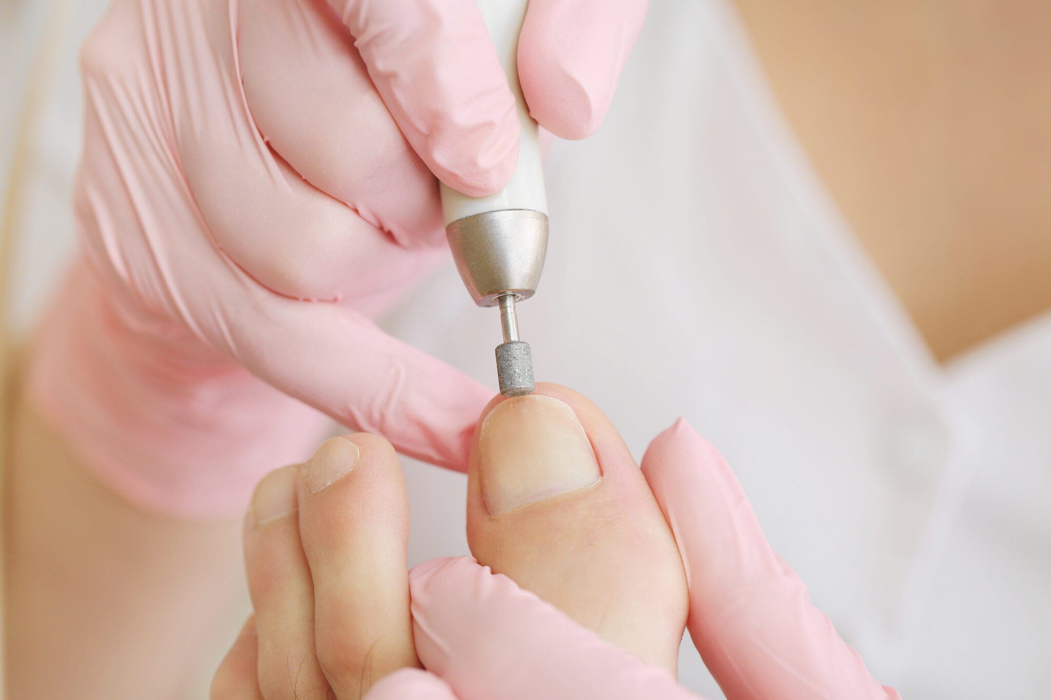 Leistungen - MED:PODO - Mobile Podologie